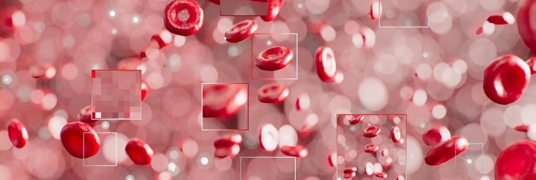 Computer Vision in Healthcare: Use Cases, Applications & Trends